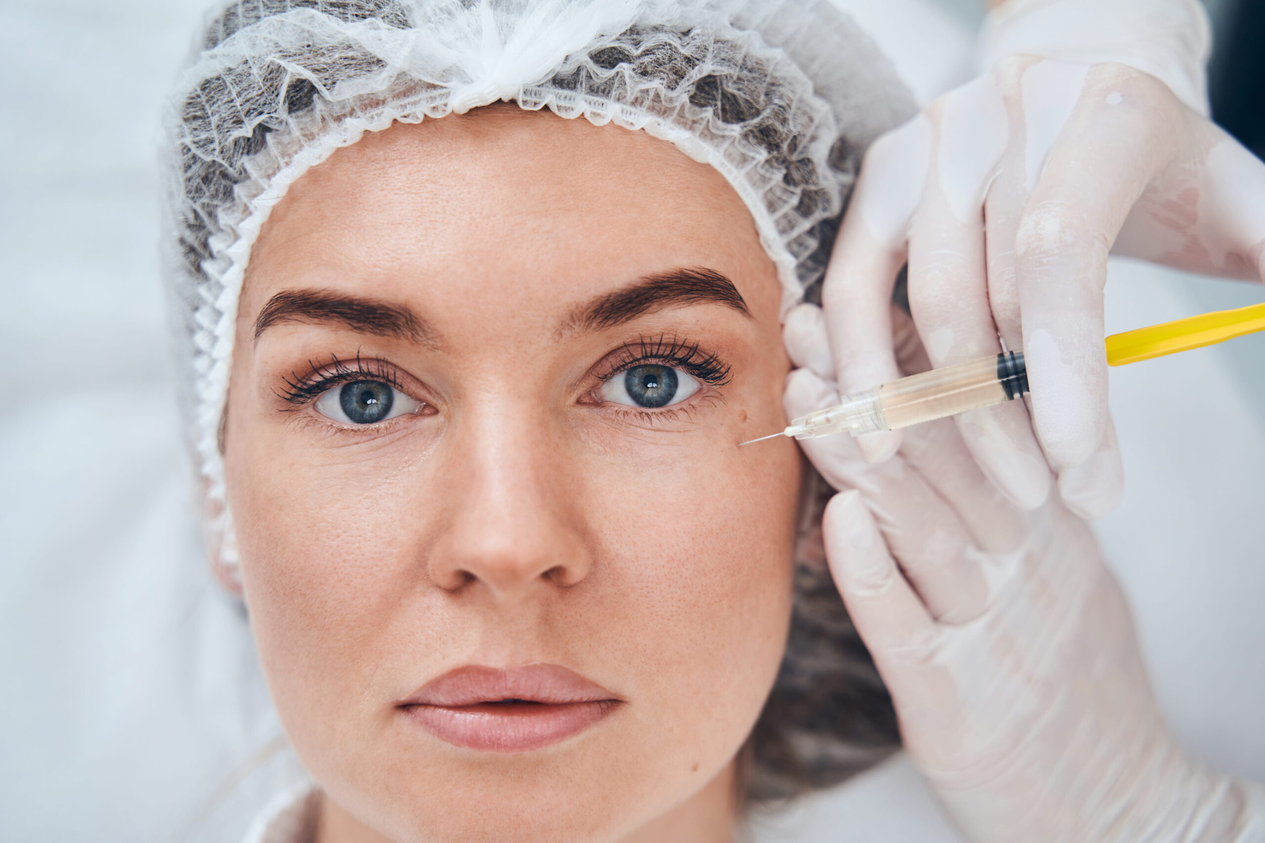 How Long Do Tear Trough Fillers Last? Results, Risks & Cost | Synergy ...